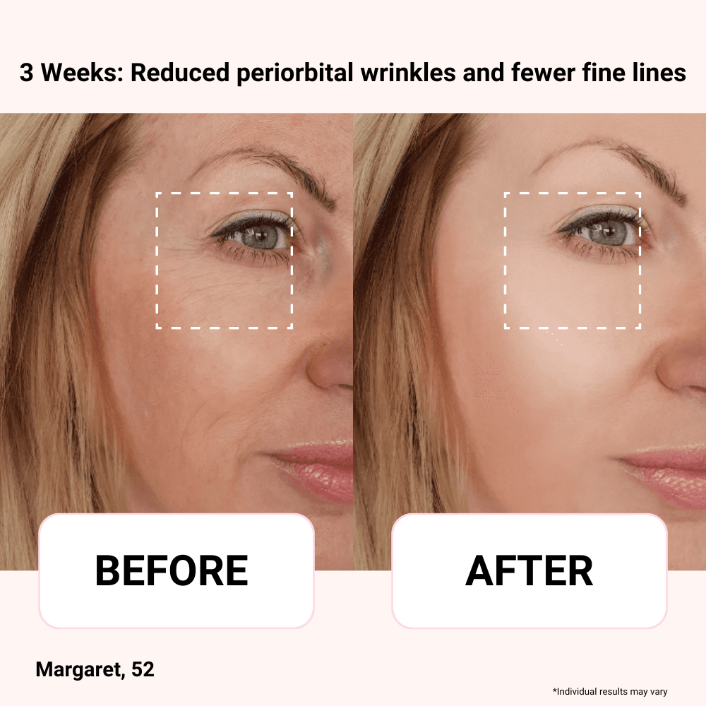 Luna&skin Booster Pro - Luxistra